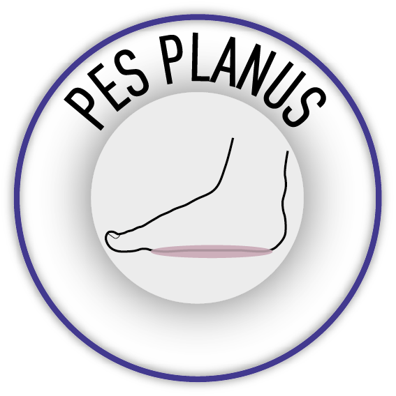 Relief for Flat Feet: TDO Therapy Shoes Provide Comfort & Support