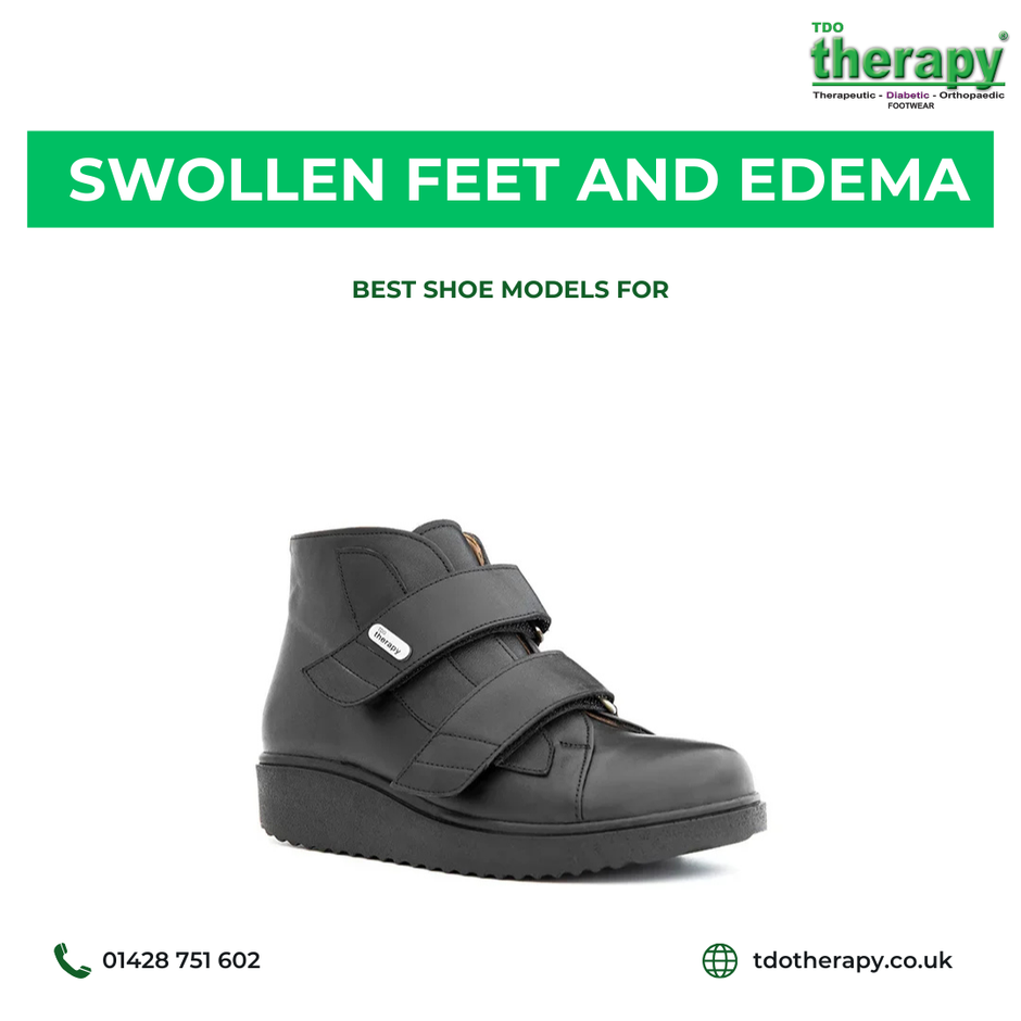 Best Shoe Models for Swollen Feet and Edema